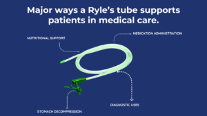Ryles tube uses: Purpose, Procedure & Safety Explained
